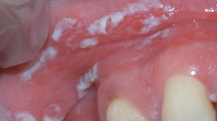 Pictures of Common Dental Problems | MouthHealthy - Oral Health ...